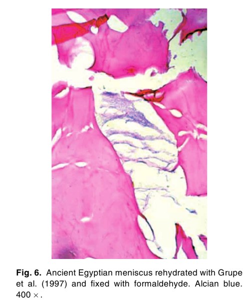 Analysis of mummified soft tissues
