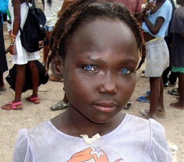 African Skin Color Range